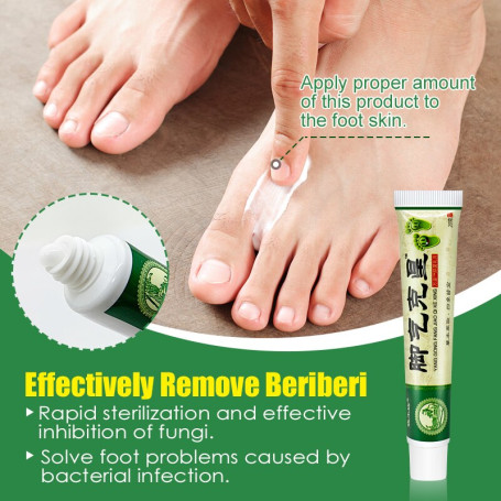 3 Types Foot Antibacterial Cream Beriberi Treatment Antifungal Cream ...