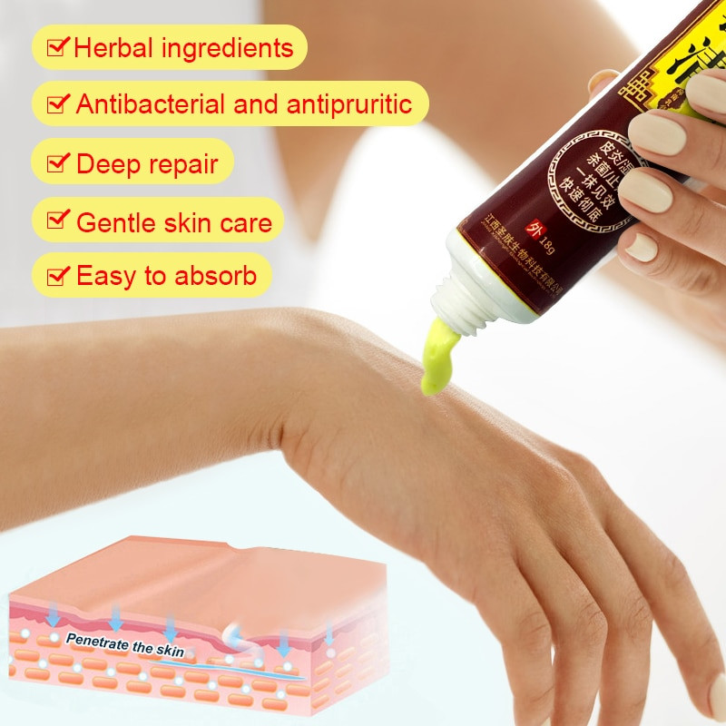 2pcs Anti-itch Psoriasis Treatment Ointment Effective Against Fungi ...