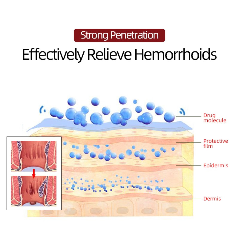 Musk Hemorrhoids Suppository Chinese Medicine Treatment External ...